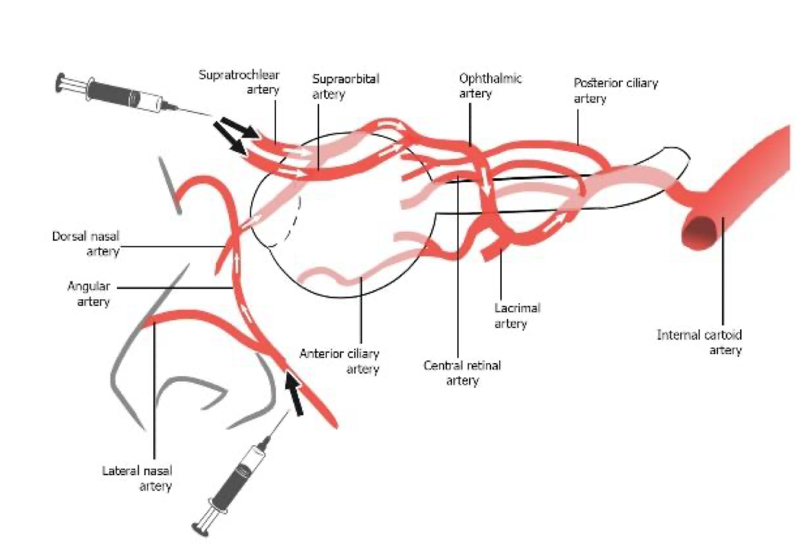 Safe and Beautiful: How to Get the Best Results from Fillers Without ...