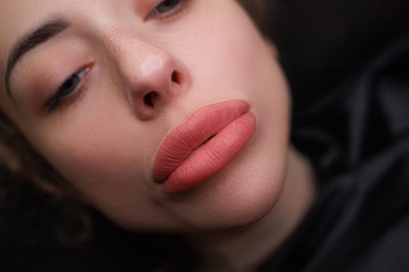 Lip Filler Migration: Causes, Treatment, and How to Prevent It - Doctor ...